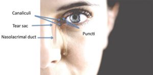 Watery eye